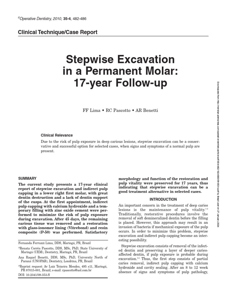 Stepwise Excavation in A Permanent Molar: 17-Year Follow-Up: Clinical ...