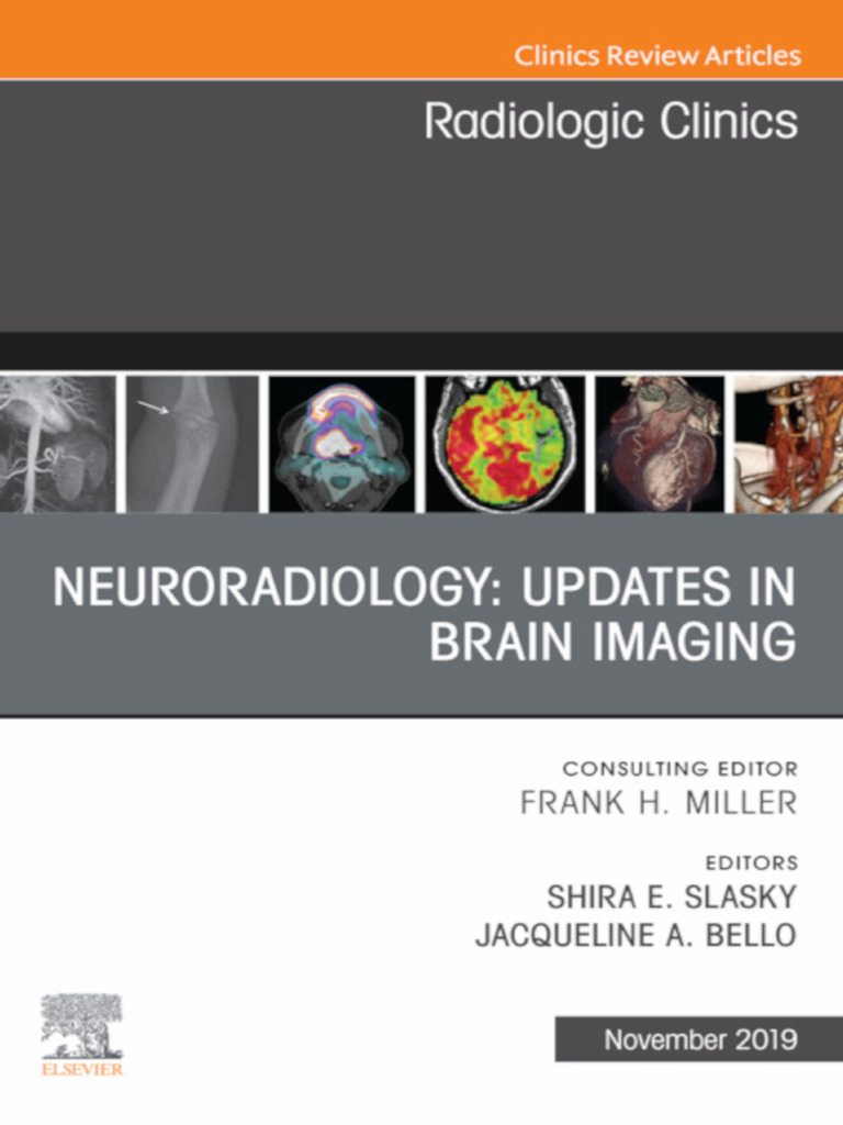 Neuroradiology- Updates in Brain Imaging | PDF | Stroke | Brain Tumor
