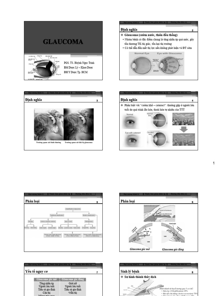 3. Glaucoma | PDF