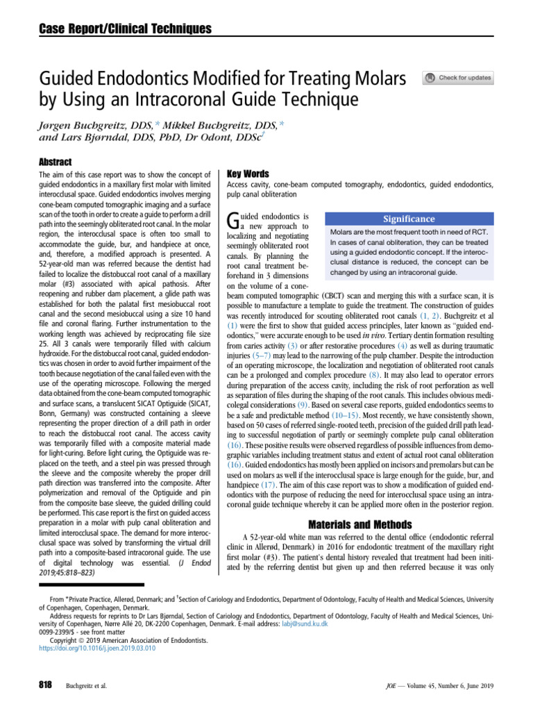 Guided Endodontics Modified For Treating Molars by Using An ...