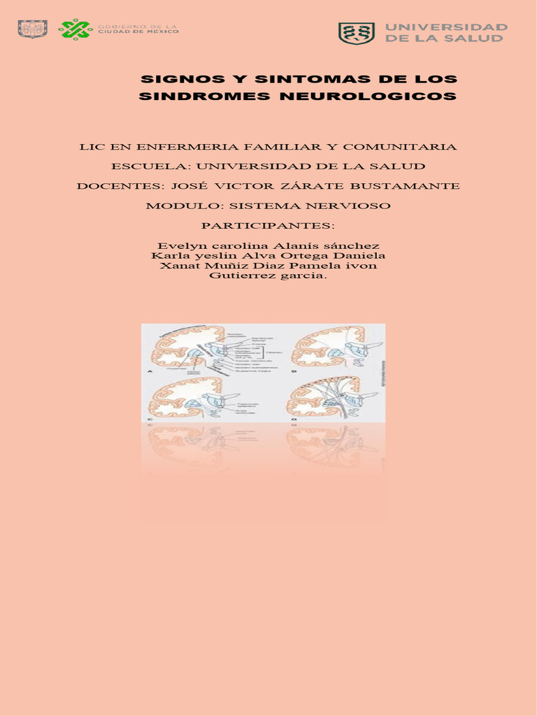 Infografía Sindrome de Extrapiramidal | PDF | Medicina CLINICA ...