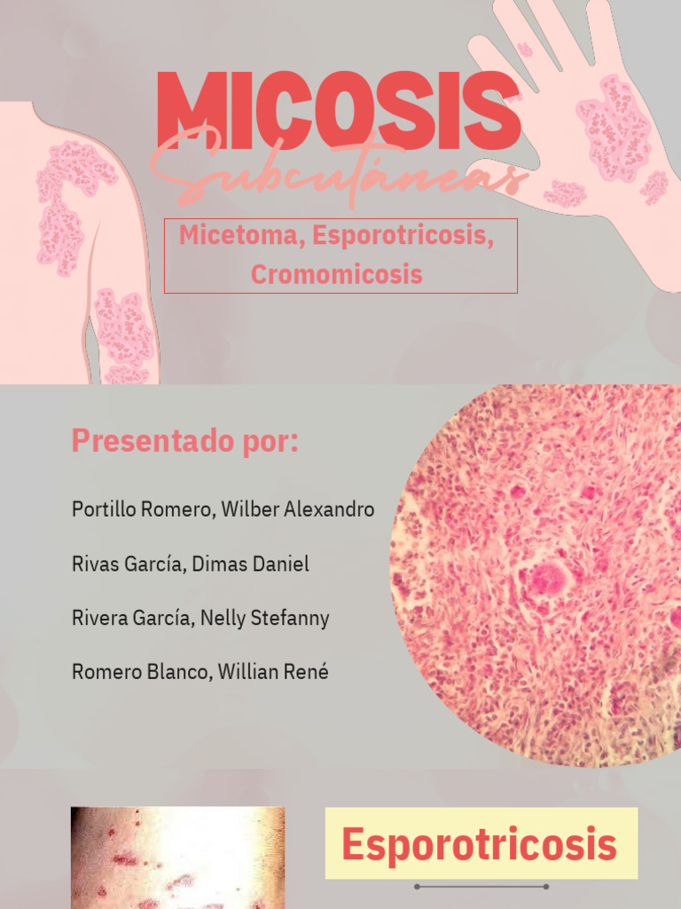 Micosis Subcutáneas | PDF | Microbiología | Enfermedades y trastornos