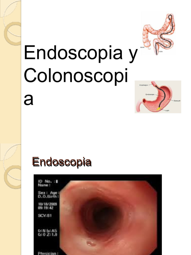 Endoscopia y colonoscopia | PDF | Endoscopia | Cáncer colonrectal