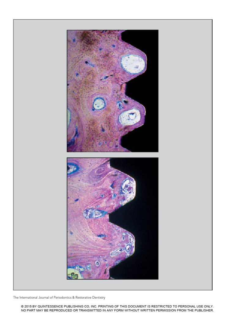 Early Bone Formation in Dental Implants | PDF | Dental Implant | Bone