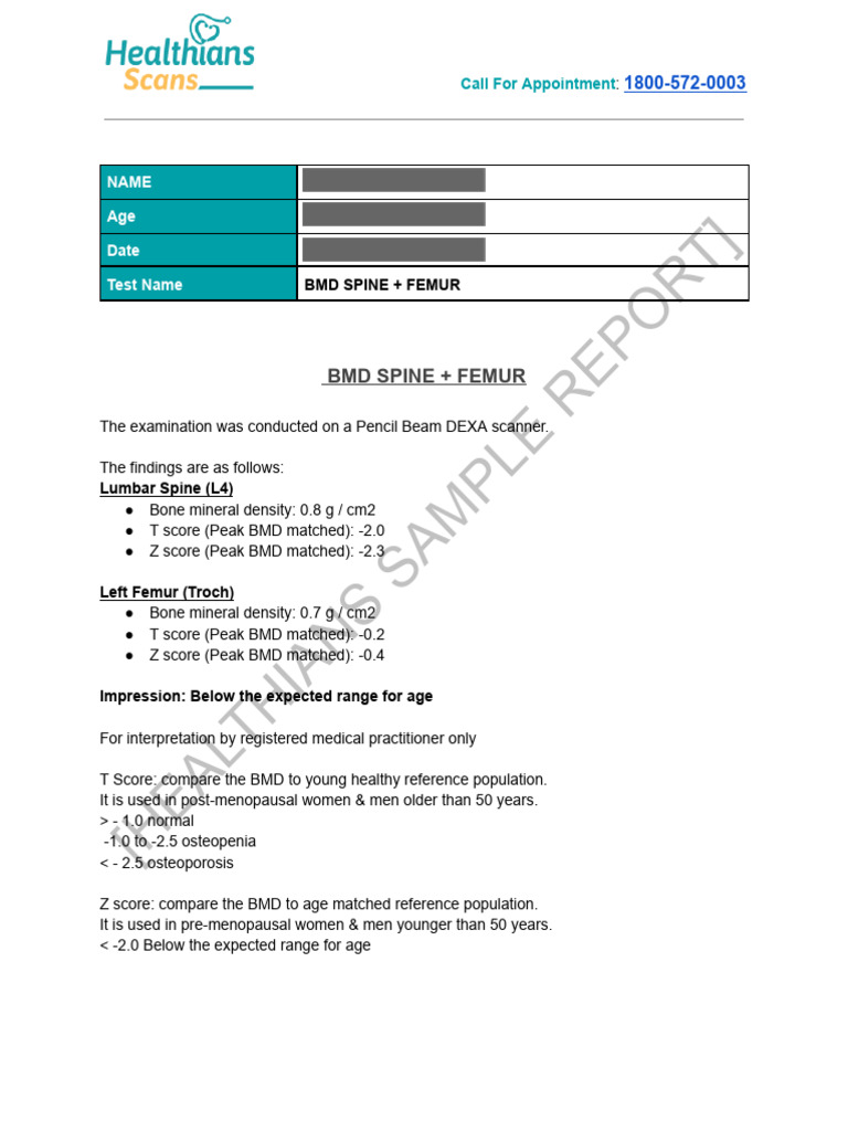 BMD Spine + Femur: Name Age Date Test Name | PDF