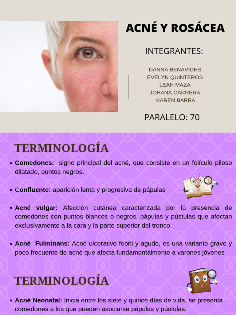 Pápulas en la cara: Acné vulgar leve | PDF | Medicina CLINICA ...
