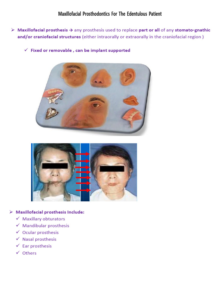 Maxillofacial Prosthodontics For The Edentulous Patient | PDF | Dental ...