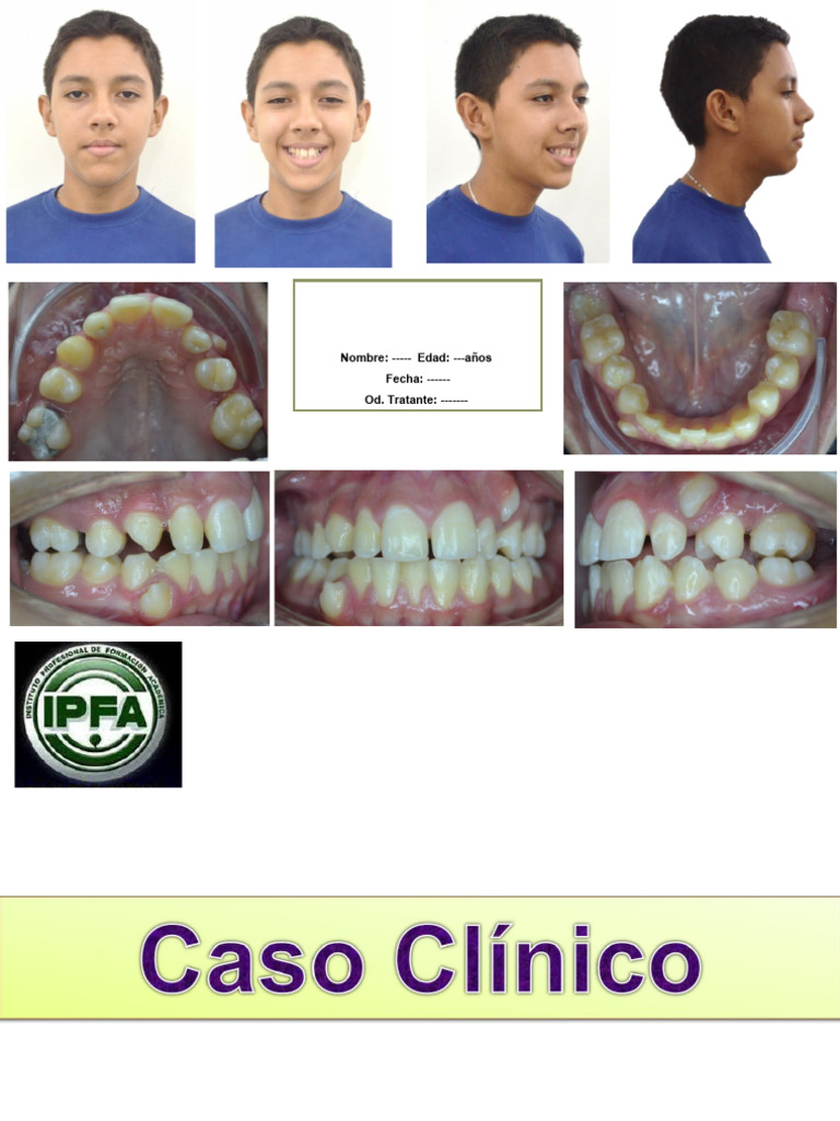 Caso Clinico Modelo | PDF | Ramas de Odontología | Boca Caso Clinico Modelo | PDF | Ramas de Odontología | Boca