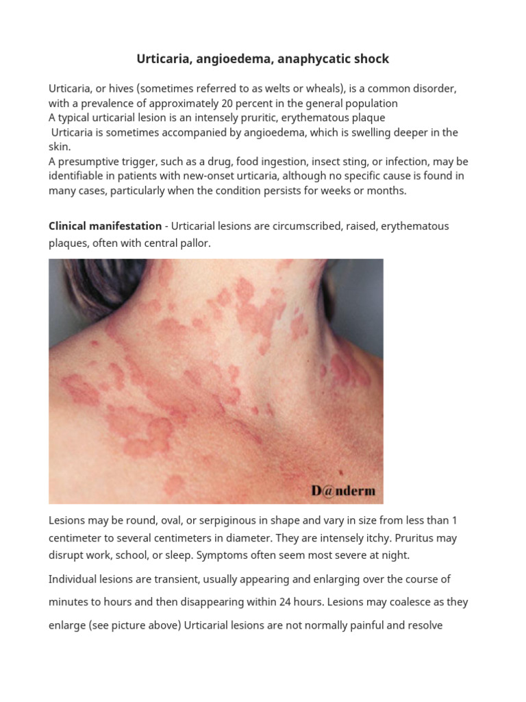 Urticaria, Drug Reactions And... | PDF | Allergy | Nonsteroidal Anti ...