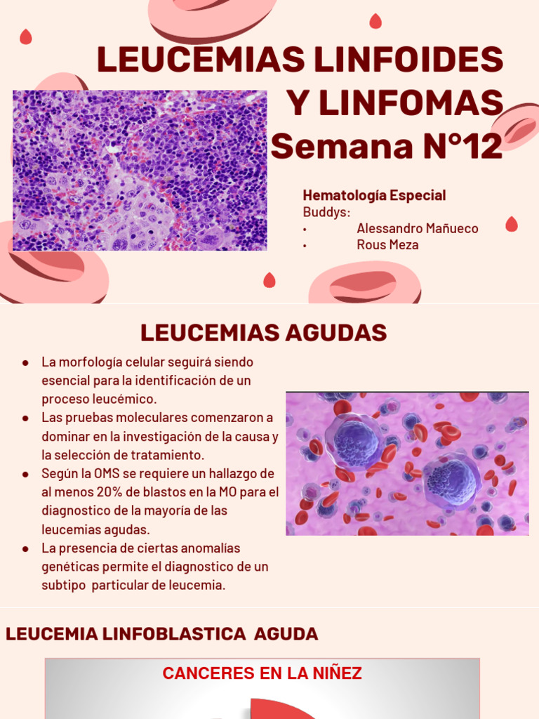 Linfomas Semana 11 - Hematología Especial | Descargar gratis PDF | Leucemia | Neoplasias