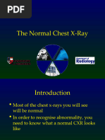 Pediatric Chest X-ray Interpretation Guide | PDF | Aorta | Thorax
