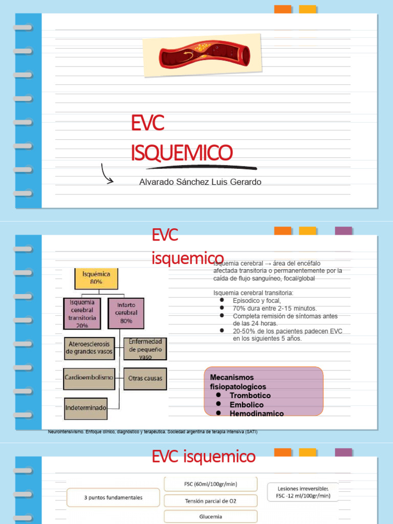 Evc Isquemico | PDF | Carrera | Isquemia