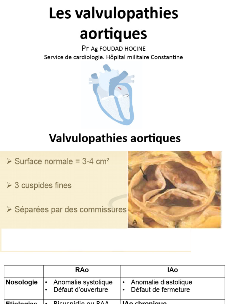 Valvulopathies aortiques : diagnostic et traitement | PDF | Système ...