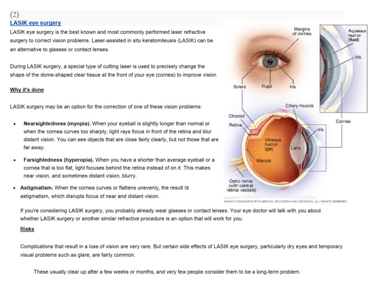 Eye Surgery | PDF