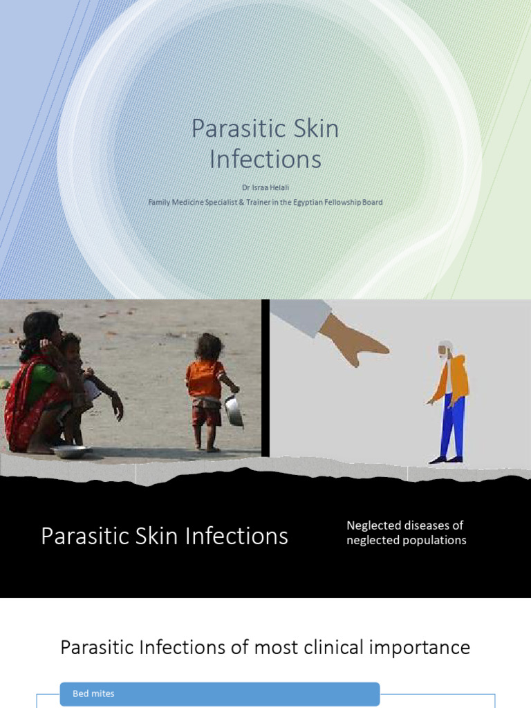 Parasitic Skin Infections | PDF | Medical Specialties | Diseases And ...