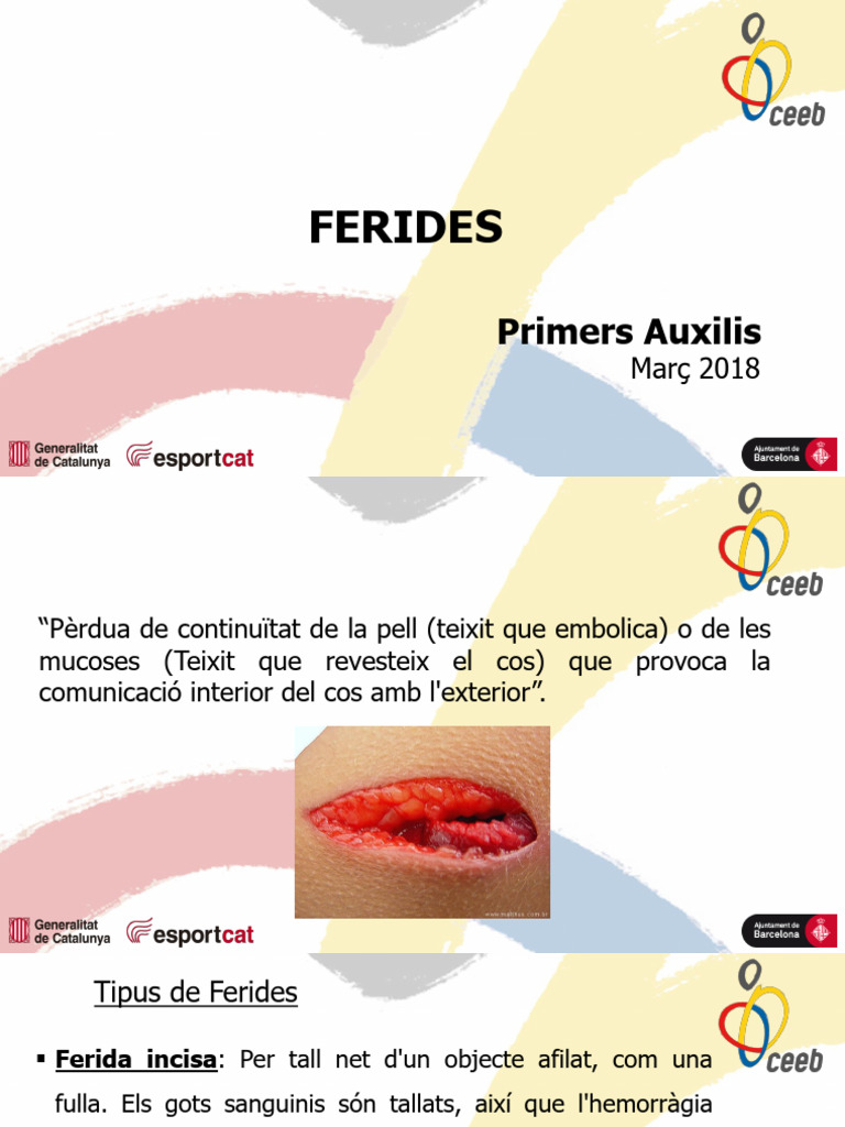 5 - Ferides | PDF