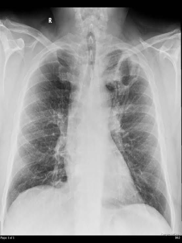 Lat Kasus Foto Ronsen Thorax | PDF