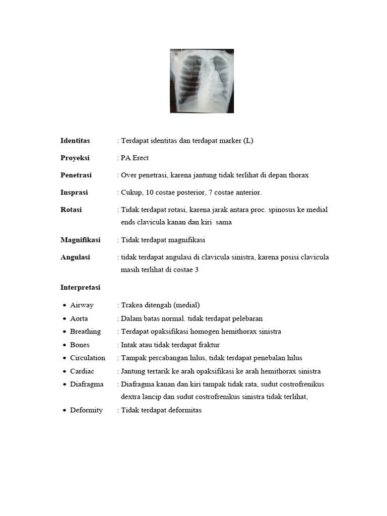 Latihan Foto Thorax | PDF | Agama & Spiritualitas