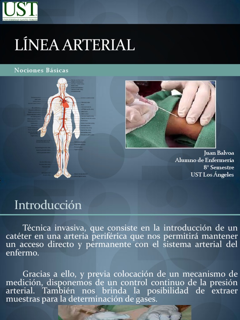 Línea Arterial Juan Balvoa