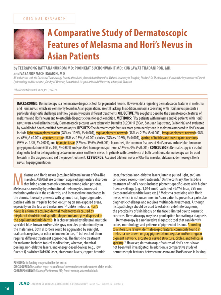 A Comparative Study of Dermatoscopic Features of Melasma and Hori’s Nevus in Asian Patients ...