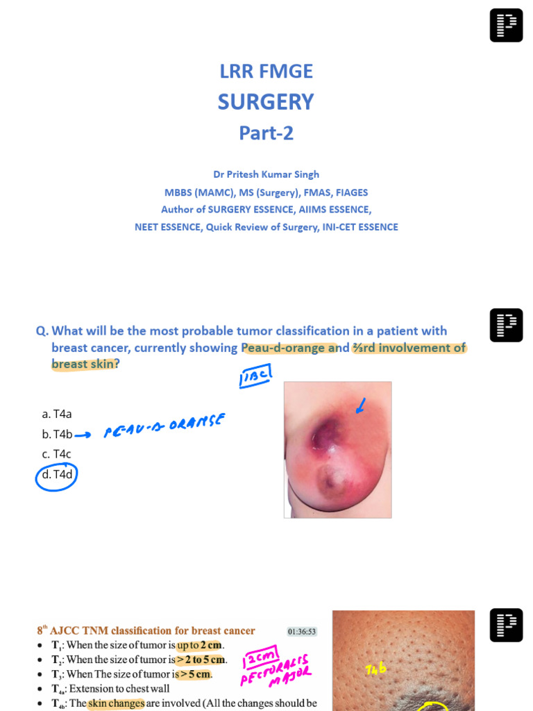 LRR FMGE Surgery Part 2 | Download Free PDF | Shock (Circulatory) | Breast Cancer