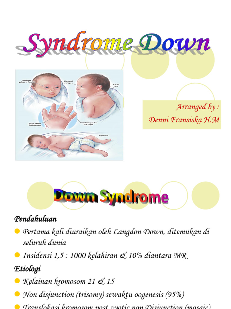 Down Syndrome | PDF | Sains & Matematika