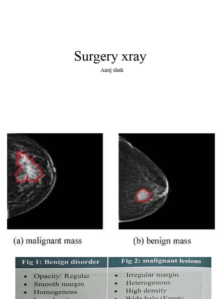Surgery Xray | PDF