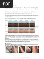 Patient-Scale POSAS-3.0 Generic-Scar English | PDF | Paresthesia | Medicine