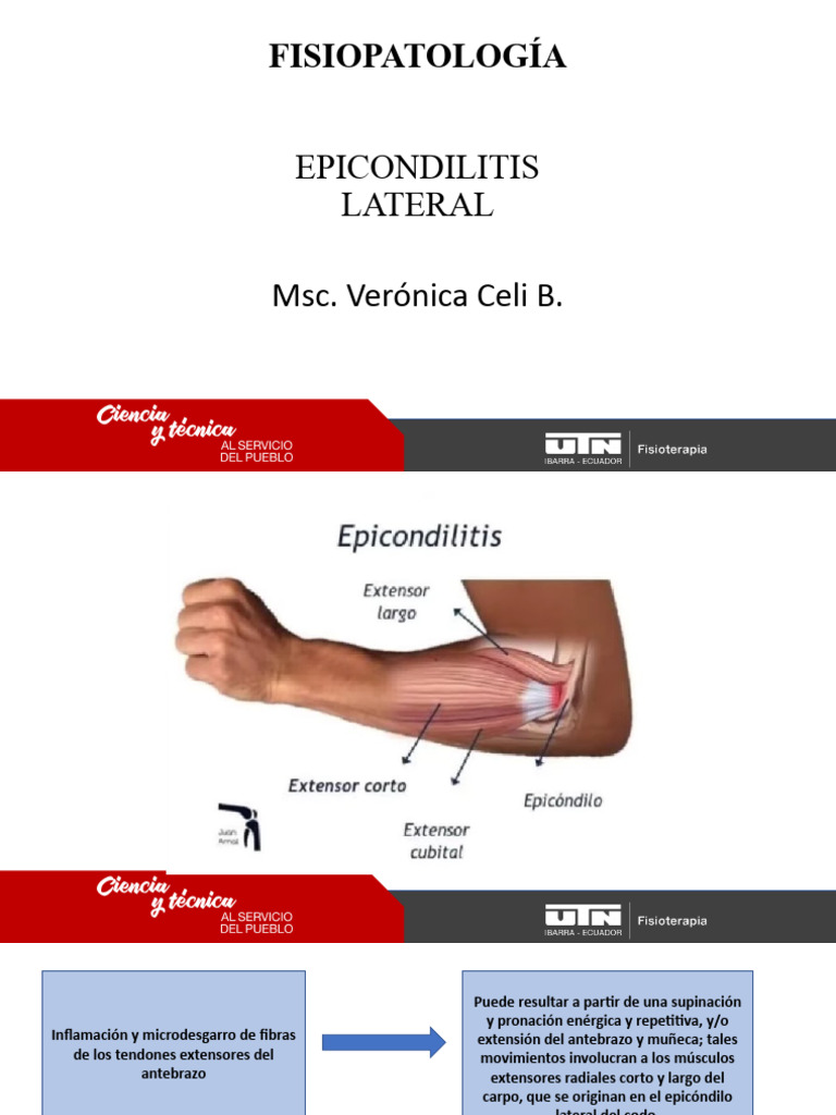 Epicondilitis Lateral y Medial | PDF | Sistema musculoesquelético ...