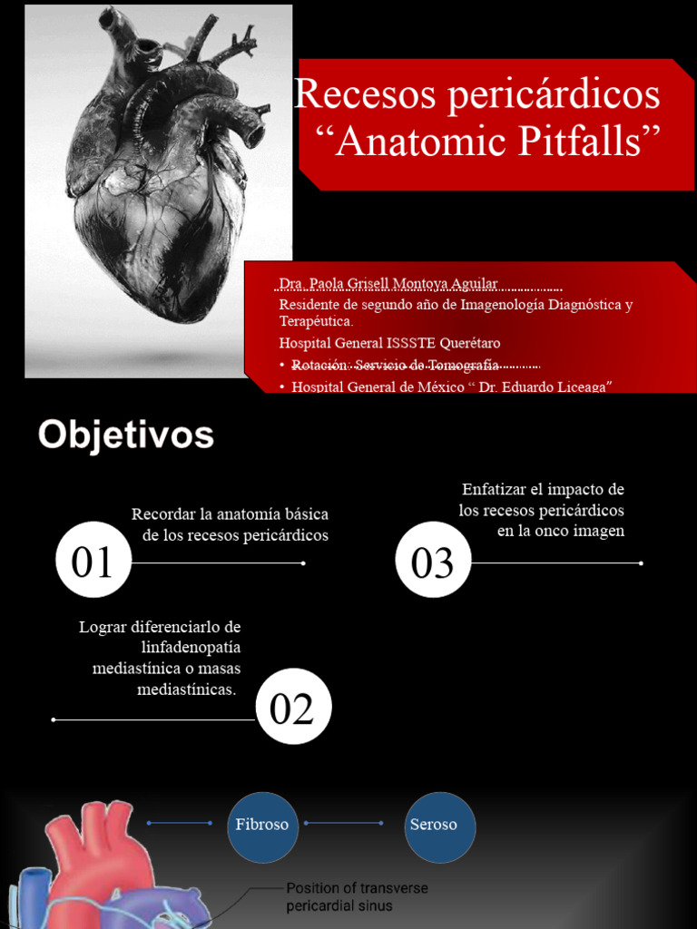 Pericardial Recess | PDF | Corazón | Tórax (anatomía humana)