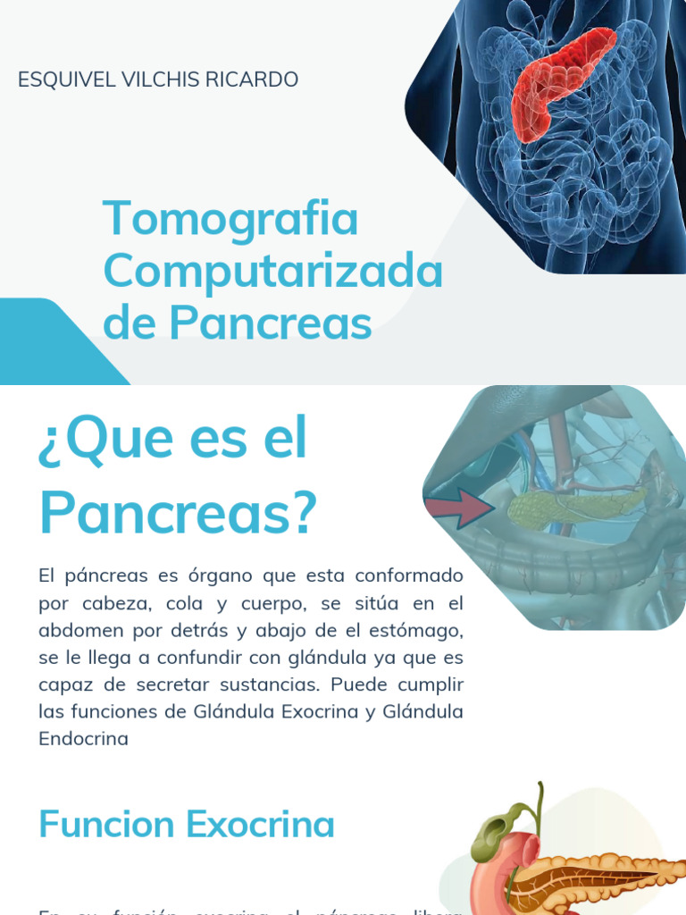 Tomografía Computarizada del Páncreas | PDF | Páncreas | Anatomia animal