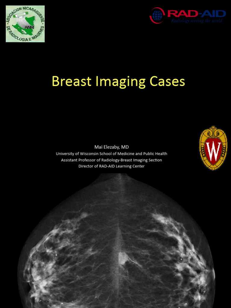 Breast imaging Cases | PDF | Breast Cancer | Breast