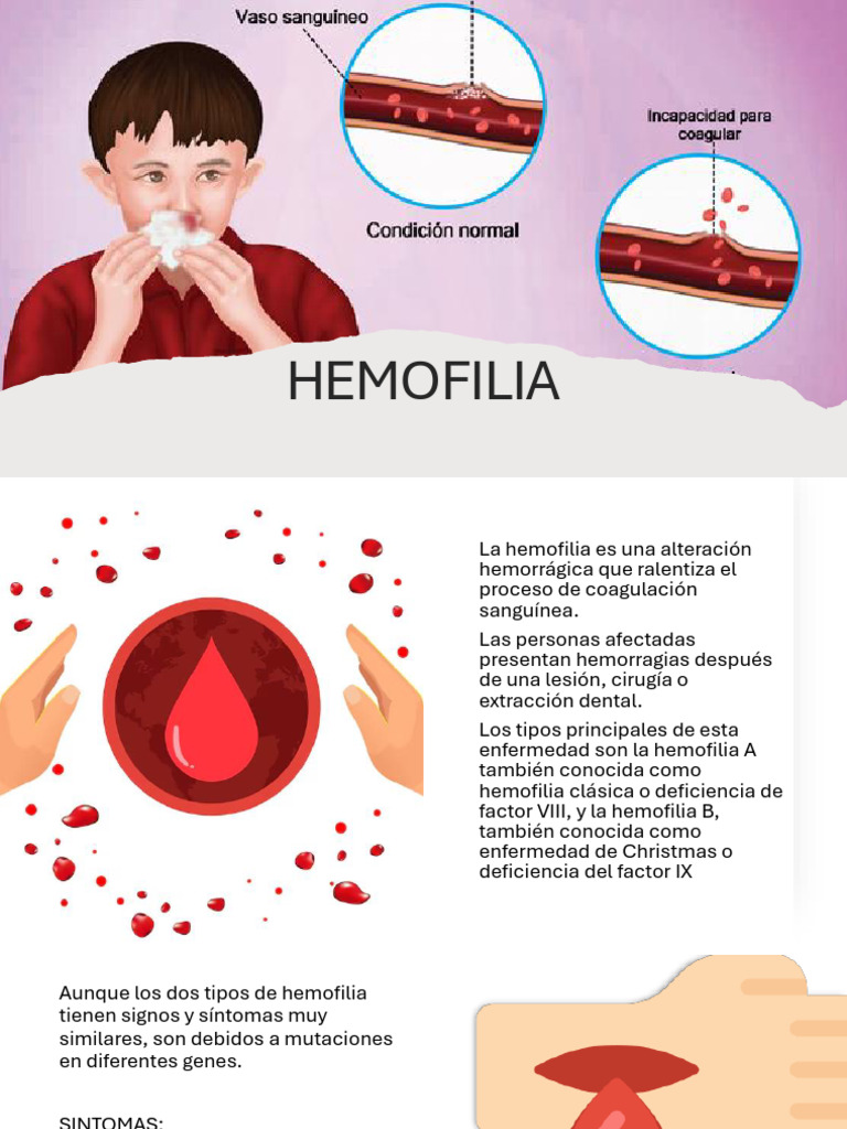 HEMOFILIA | PDF | Hemofilia | Coagulación