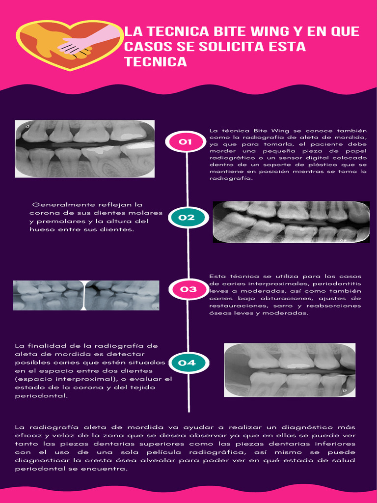 LA TECNICA BITE WING Y EN QUE CASOS SE SOLICITA ESTA TECNICA | PDF