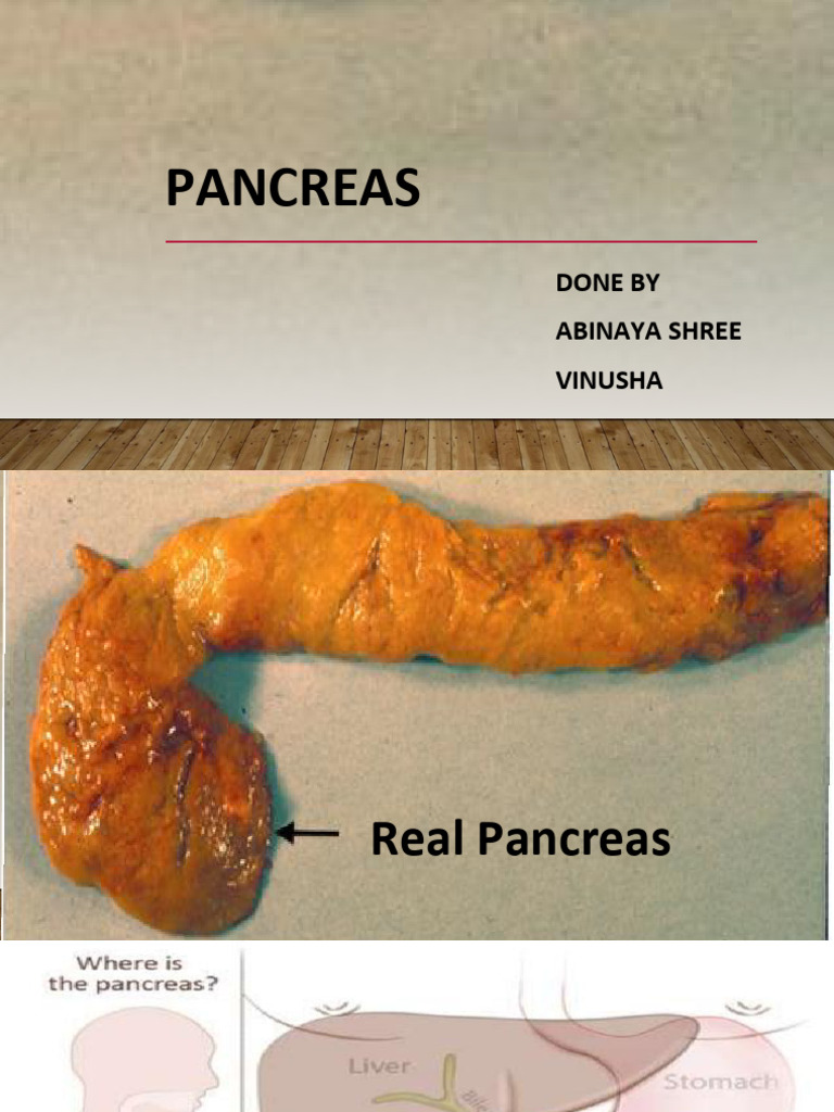 Wa0023 | PDF | Pancreas | Diabetes