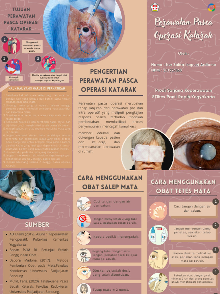 Leaflet Katarak | PDF