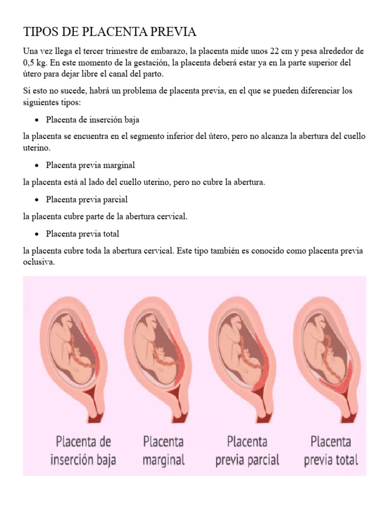 Etiologia y Dx Placenta Previa | PDF | El embarazo | Medicina