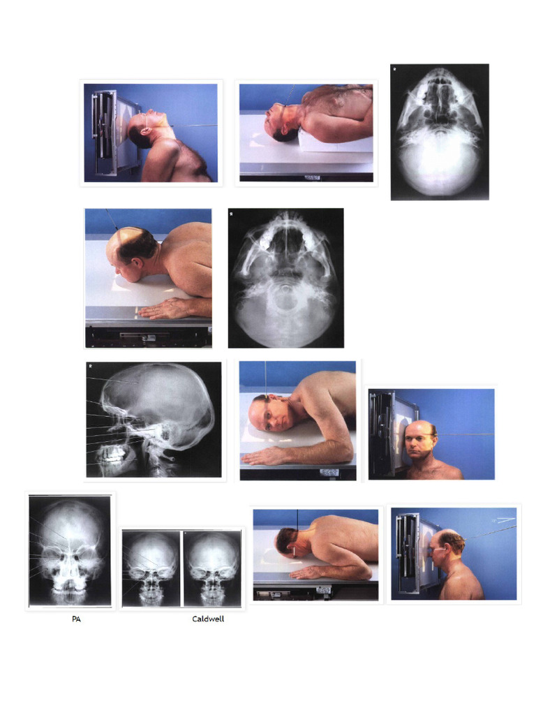 Foto TP Cranium Dan Cranial Base | PDF