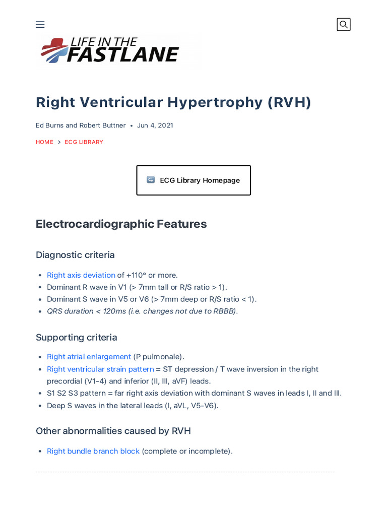 Right Ventricular Hypertrophy (RVH) - LITFL - ECG Library Diagnosis ...