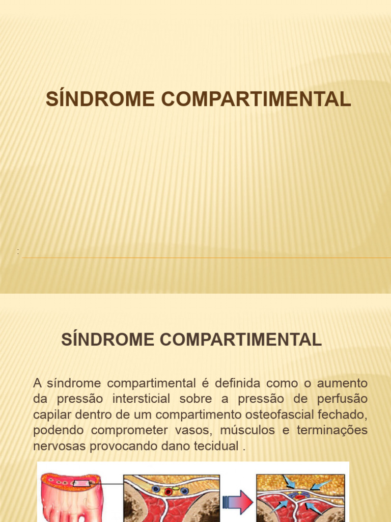 Síndrome Compartimental | PDF | Medicina Clínica | Especialidades médicas