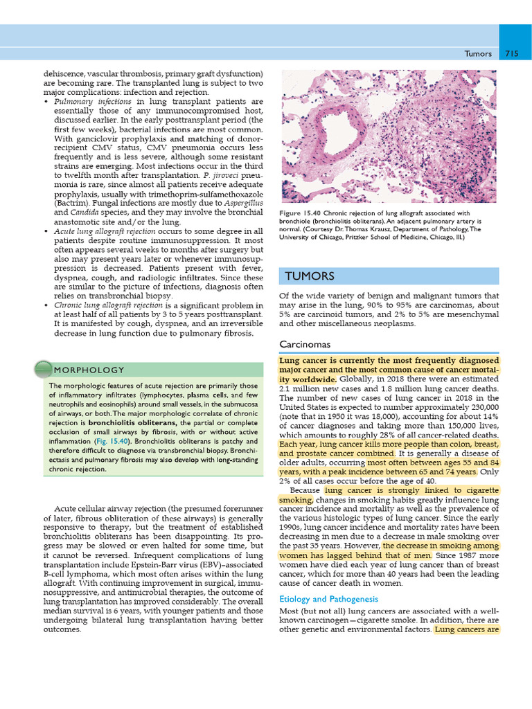 Cancer Robbins | PDF | Lung Cancer | Cancer