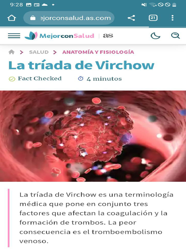 Tríada de Virchow | PDF