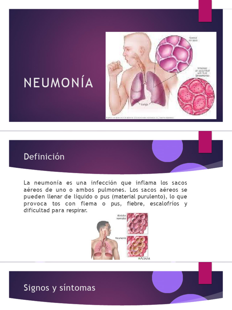 Neumonía: Síntomas, Causas y Tratamiento | PDF | Relaciones personales ...