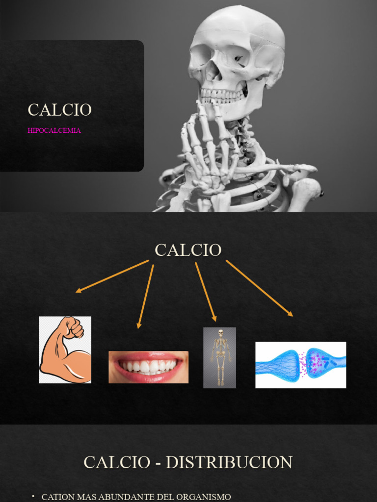 HIPOCALCEMIA | PDF | Calcio