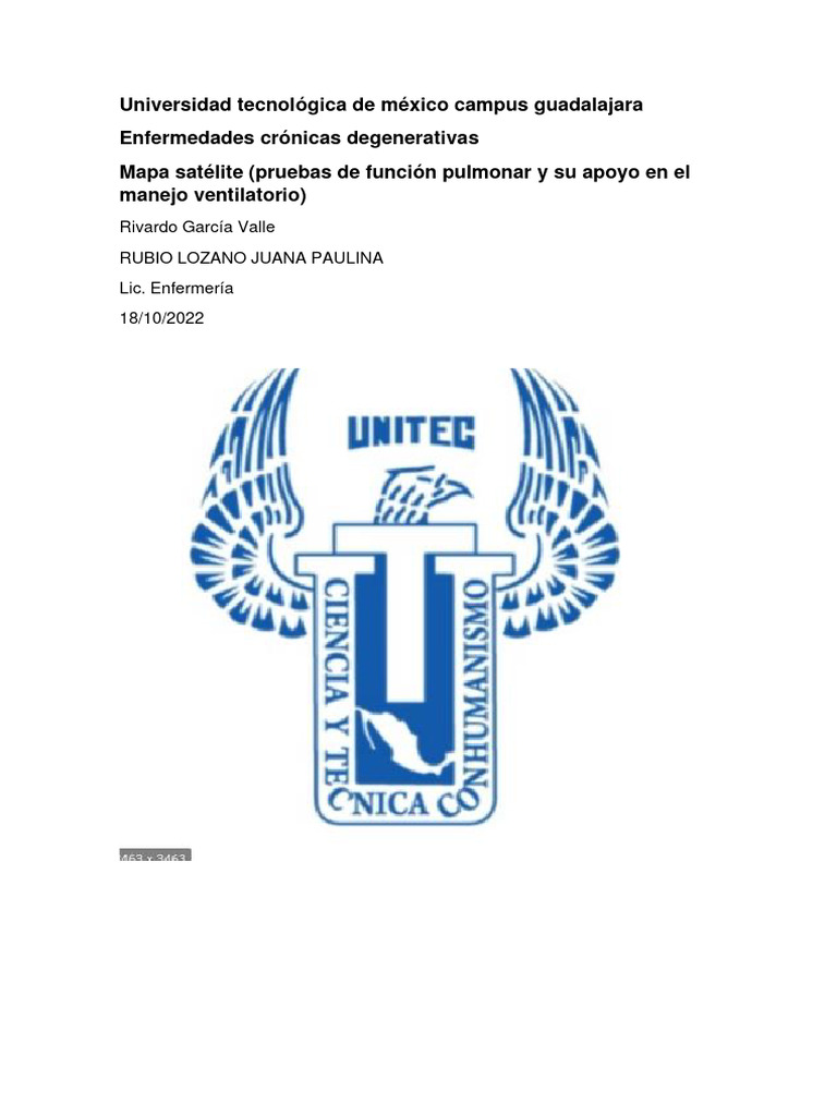 Mapa Satélite | PDF | Pulmón | Sangre