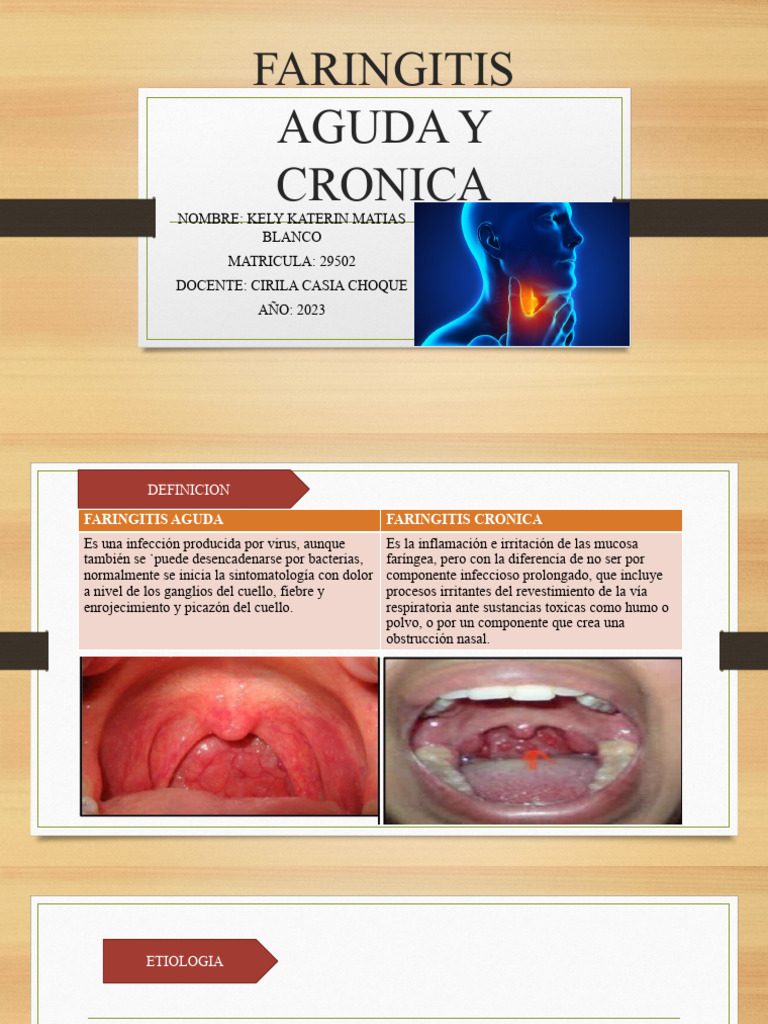 Diserytacion de Faringitis | PDF | Virus | Inmunología