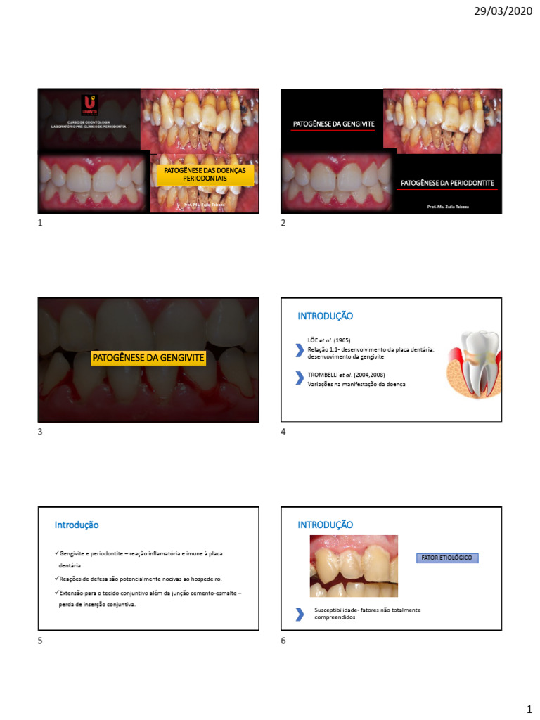 PATOGÃ - NESE DAS DOENÃ - AS PERIODONTAIS Ensino Hibrido | PDF ...