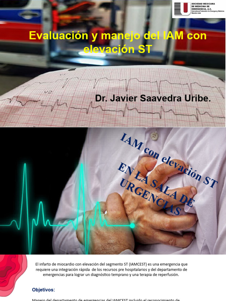 Evaluación y Manejo Del IAM Con Elevación ST Abril 2021 | PDF | Infarto ...