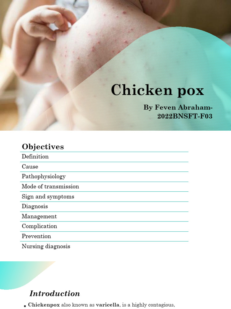 Chickenpox | PDF | Medical Specialties | Immunology