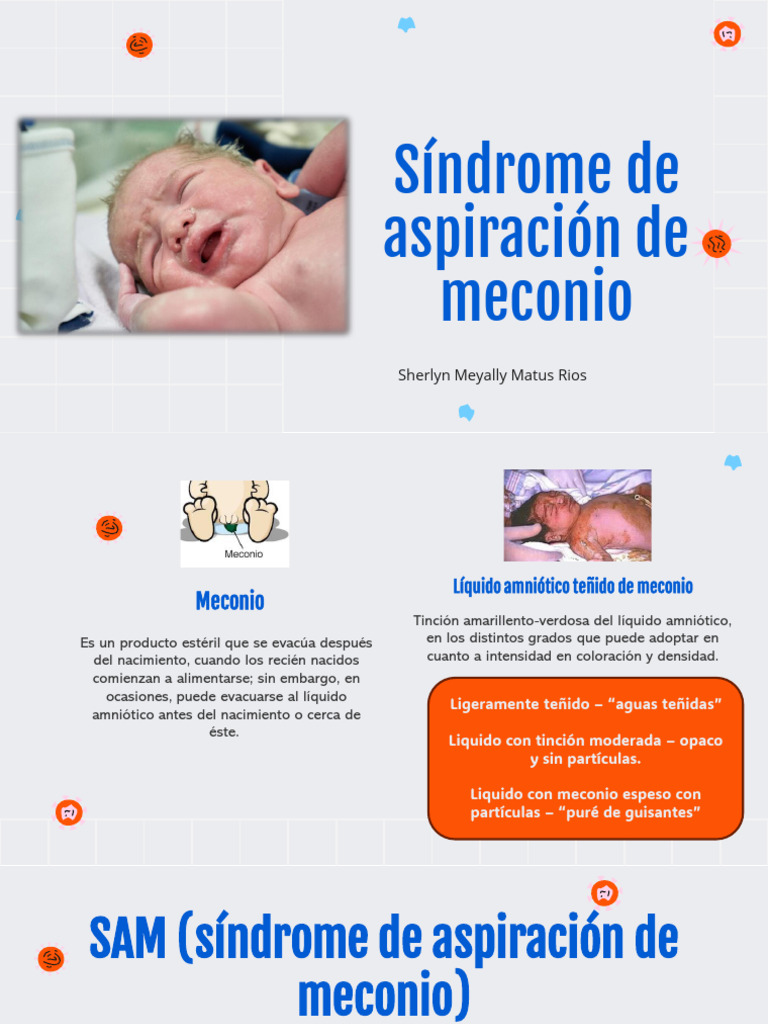 Síndrome de Aspiración de Meconio: Guía Clínica | PDF | Epidemiología ...